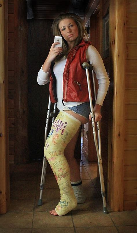 Pin By Med Cast On Long Leg Casts Long Leg Cast Leg Cast Ankle Cast Eroppa