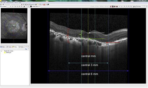 User Interface Of The Octavo Multivendor Optical Coherence Tomography