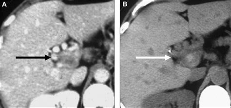 Axial Contrast Enhanced And Non Enhanced Computed Tomography Ct Scans