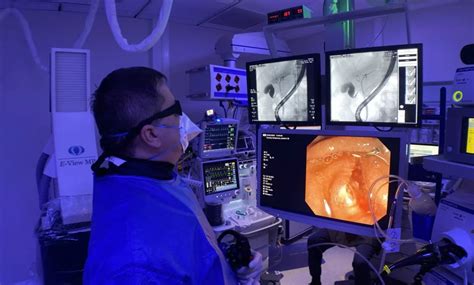 Fluoroscopy And Procedural Time During Ercp Omega Medical Imaging
