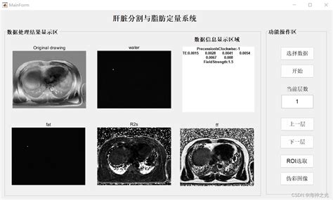 【肝脏分割】基于matlab gui计算机视觉肝脏分割和脂肪定量系统【含matlab源码 2528期】 怎么用matlab实现肝脏分割 csdn博客