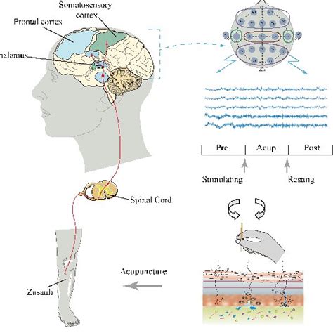 Schematic Diagram Of Acupuncture Electroencephalographic Signals Download Scientific Diagram