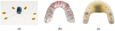 Intelligent Occlusion Stabilization Splint With Stress Sensor System