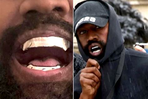 Kanye West Bottom Teeth Kanye West Can No Longer Chew Food As