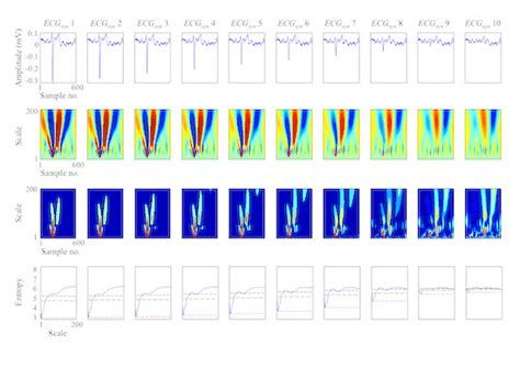 Entropy Special Issue Wavelet Entropy Computation And Applications