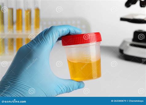 Nurse Holding Container With Urine Sample For Analysis In Laboratory
