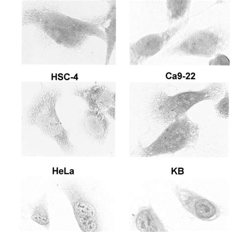 Vegf Expression And Secretion In Human Scc Cell Lines A Vegf