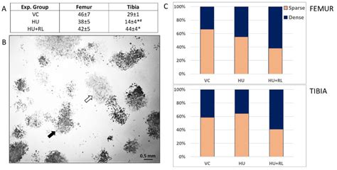 Mouse Femur And Tibia