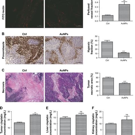 Aunps Reduced Solid Stress In Sw620 Tumor Notes An Ex Vivo Technology
