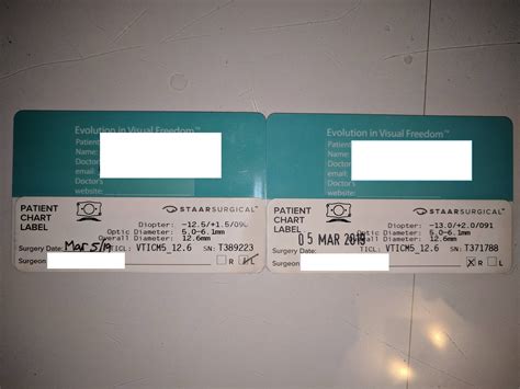 My Detailed Visian Toric Icl Experience 4 Months Post Op Lasik