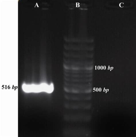 Amplification Of Apn Using Exon Junction Primers A 516 Bp Fragment Download Scientific