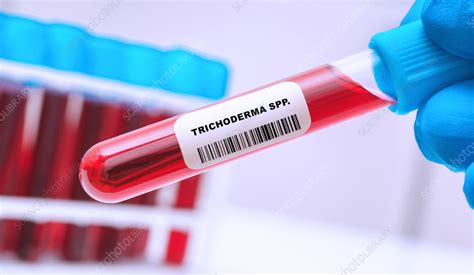 Trichoderma Fungus Stock Image F045 1339 Science Photo Library