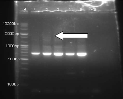 Figure 1 From Molecular Detection Of Anaplasma Phagocytophilum In