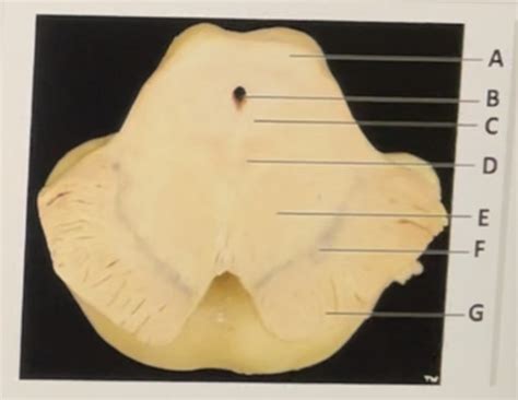 Quizzes Flashcards Quizlet