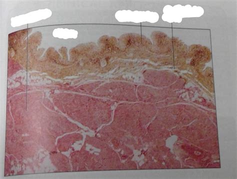 Urinary Wall Bladder Diagram Quizlet