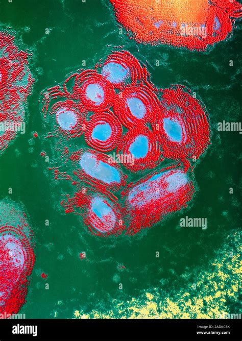 Granules In A Mast Cell Coloured Transmission Electron Micrograph Tem