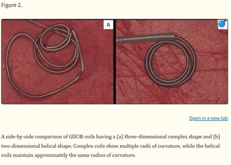 Design And Biocompatibility Of Endovascular Aneurysm Filling Devices