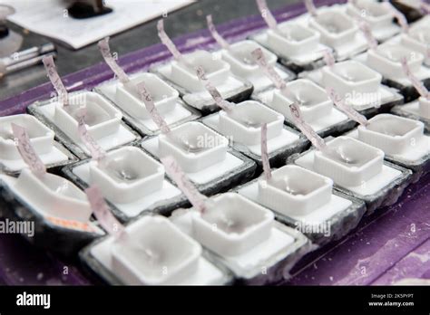 Embedded Tissues In Paraffin Blocks For Sectioning Pathology Laboratory Cancer Diagnosis Stock