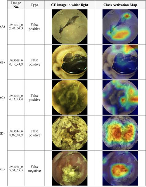 Examples Of Several Class Activation Maps Of Misclassified Images A