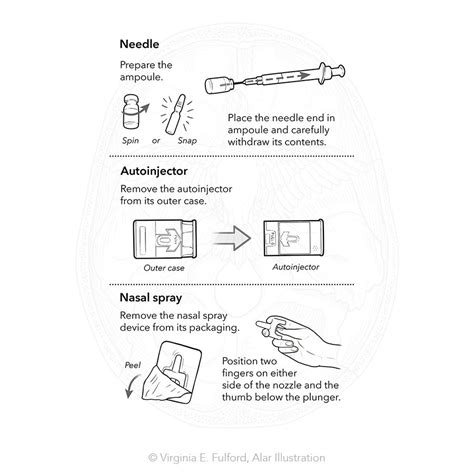 Medical Illustration — Alar Illustration