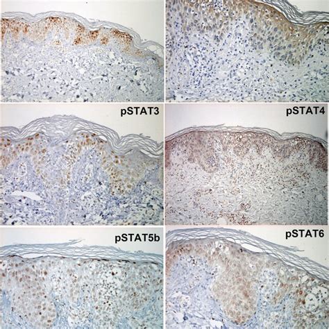 Representative Paraffin‐embedded Tissue Samples From The Lesional Skin Download Scientific