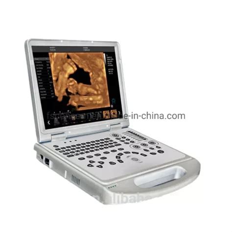 Hospital Clinic Laptop Ultrasonic Scanning System Portable Color Ultrasound Scanner Machine
