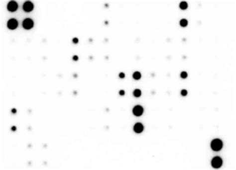 Human Rtk Phosphorylation Array 71 Targets