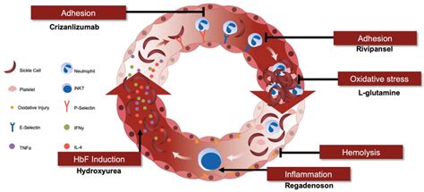 Sickle Cell Pain Crises Role Of Pharmaceutical Interventions In