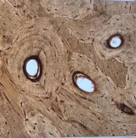 Solved Label The Central Canal Lucunae Osteon And Small