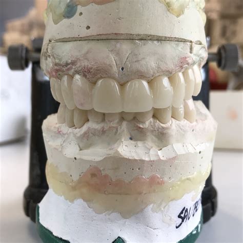 Oak Tree Dental Lab
