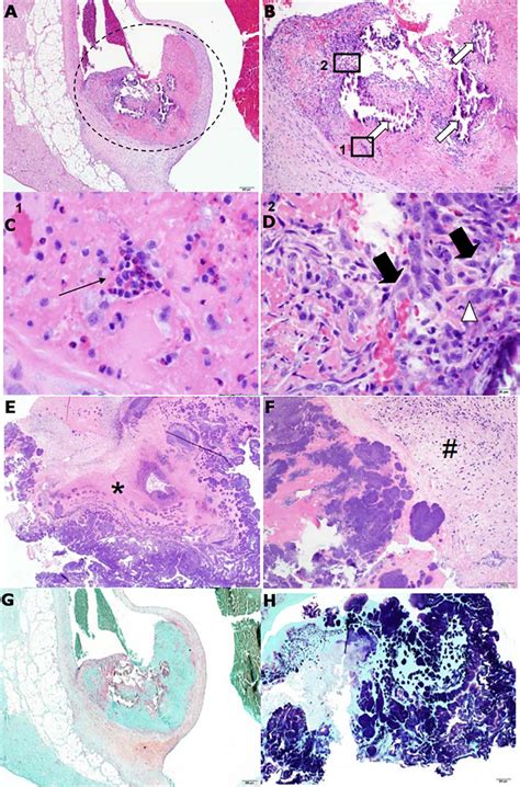 Frontiers Association Of Novel Streptococcus Sanguinis Virulence Factors With Pathogenesis In