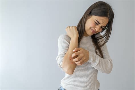 What Is Eczema And How To Treat It Buckhead Dermatology
