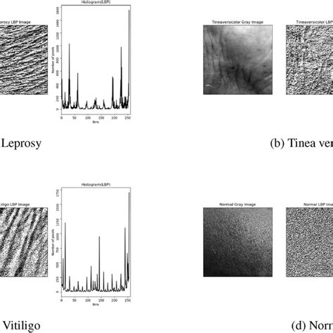 Histogram And Scaled Map Of Differential Excitation Download
