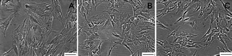 Microscopic Appearance Of Mscs A Bm Derived Mscs B Ucb Derived