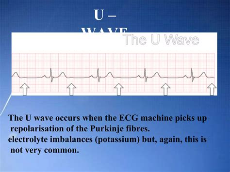 Ecg Basic Guidelines Ppt