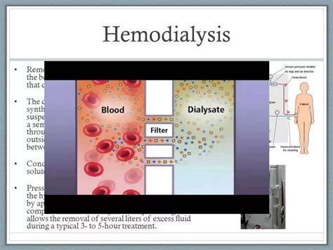 Hemodialysis Complications Pptx