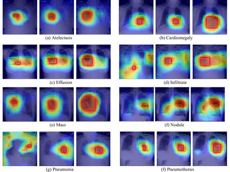 Sample Localization Heatmaps And Bounding Boxes Generated By Standard