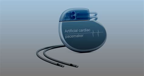 Pacemaker Implantation Doctor In Kolkata Aicd Pacemaker And Device