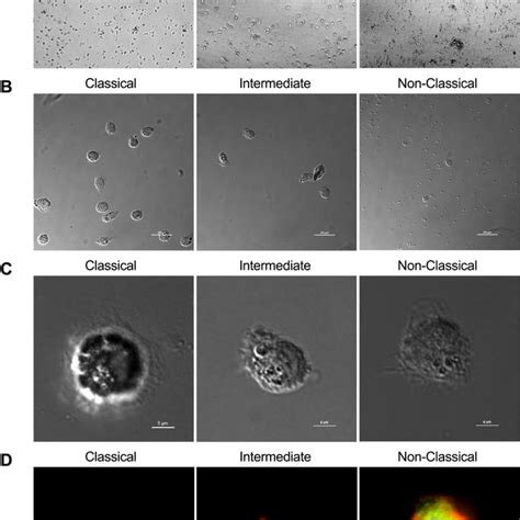All Monocyte Subsets Differentiate To Macrophages With Culture In