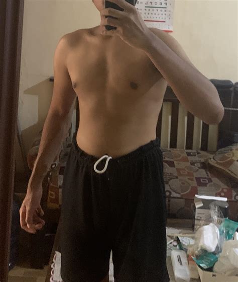 Gyno Or Fat Rgynecomastia
