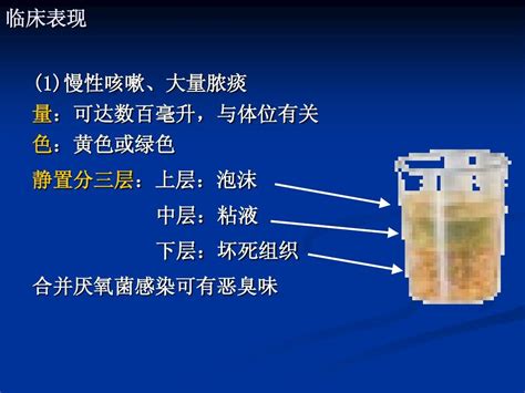 内科护理学 支气管扩张word文档在线阅读与下载无忧文档