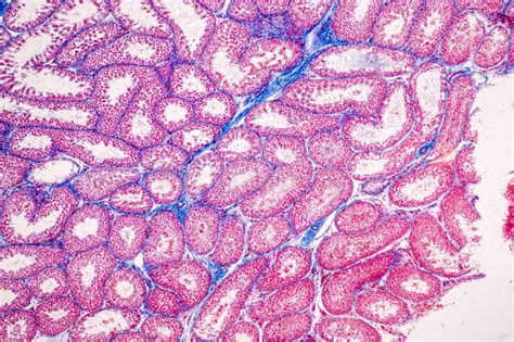 Histological Epididymis And Testis Human Cells Under Microscope Stock Image Image Of