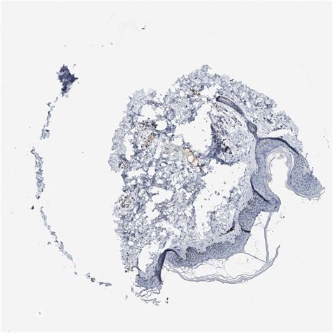 Tissue Expression Of Cd200 Staining In Skin The Human Protein Atlas