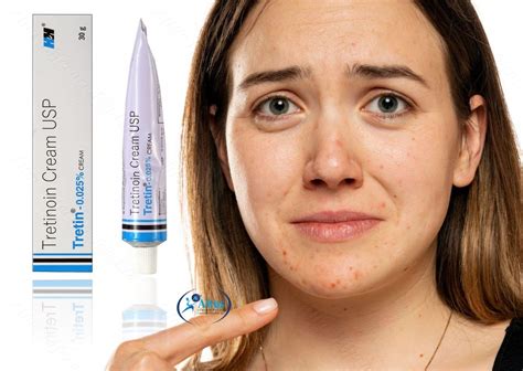 Flawless Skin Is Possible Tretin Creams Incredible Benefits