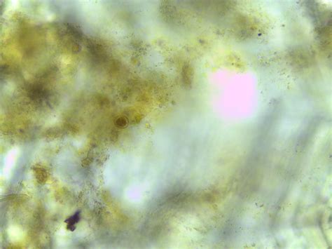 55 Questions With Answers In PROTIST Science Topic