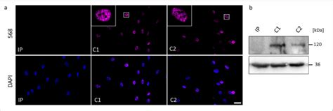 The Rbm Protein Analyses In Skin Fibroblasts From The Tarp Affected