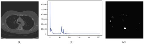 Optimal Thresholding For Multi Window Computed Tomography Ct To