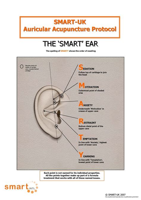 40 Best Images About Methodauricular Acupuncture On Pinterest