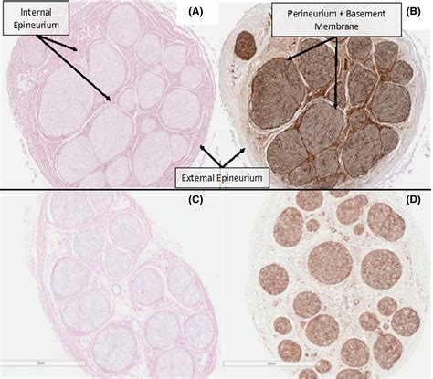 Peripheral Nerve Histology Cross Section