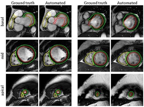 Example Segmentation Using The Proposed Fcn Compared To The Gold Download Scientific Diagram